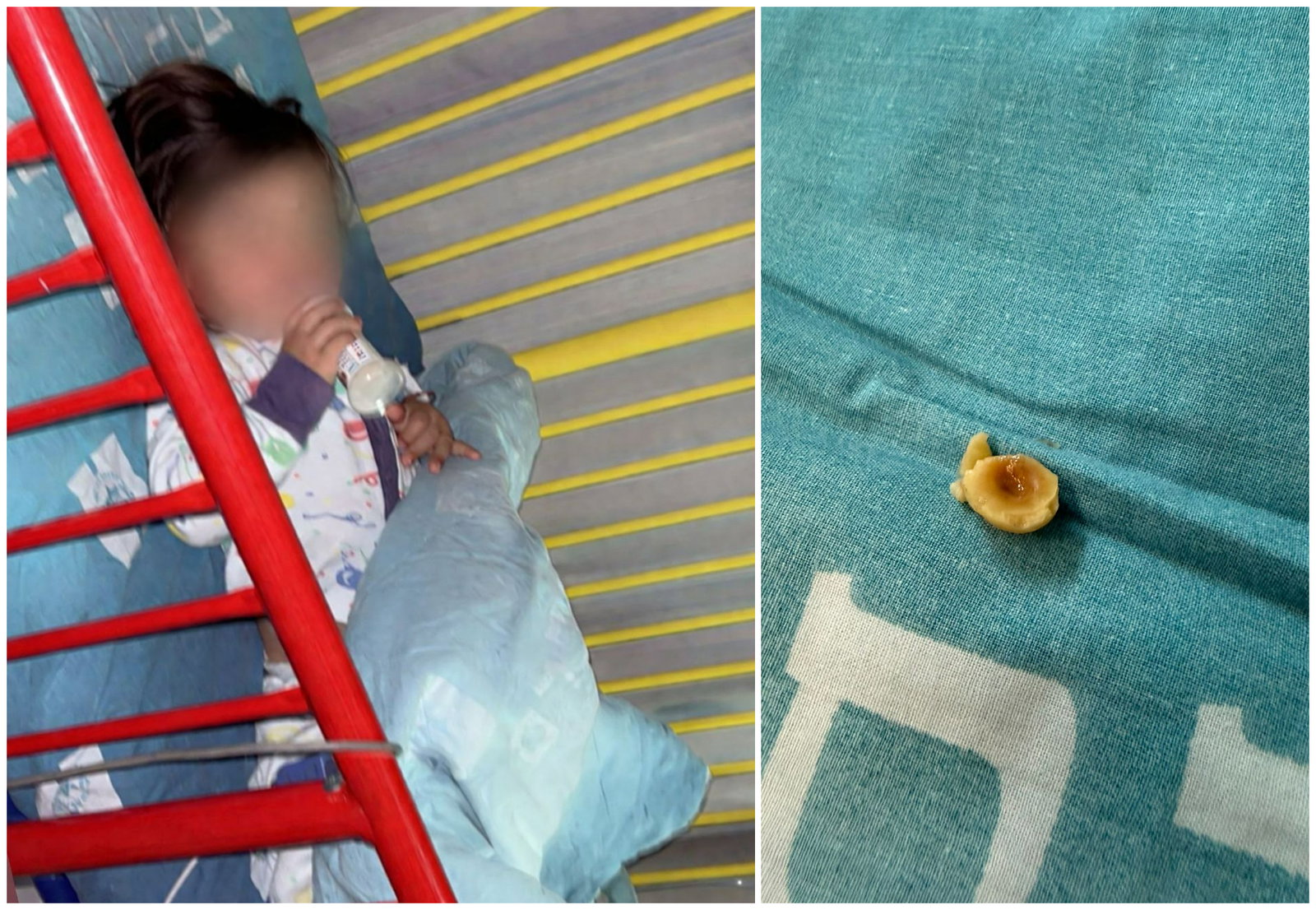 אגוז נתקע בוושט פעוט: ניתוח חירום הציל חיים בהדסה | כיכר השבת